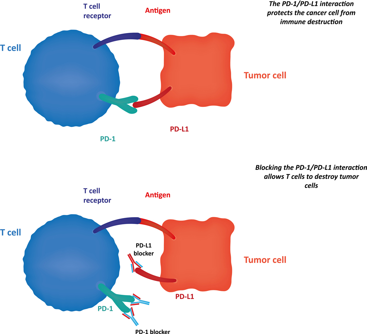 Le carcinome à cellules de Merkel - ECPC - European Cancer Patient ...